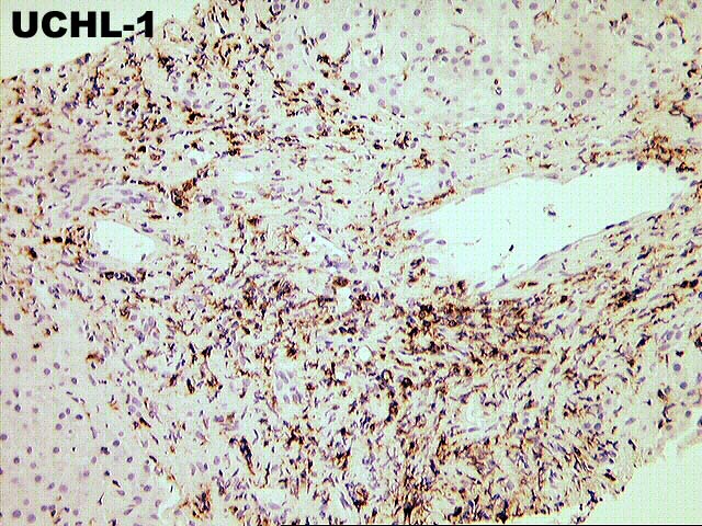 Consult Report - Case 17