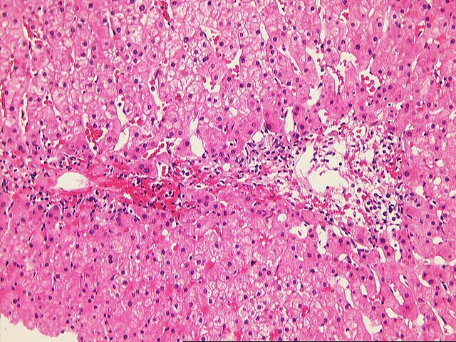 Consult Report - Case 21