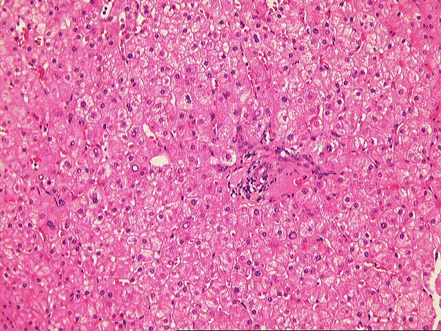 Consult Report - Case 21